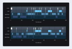What Is a Polysomnography (PSG) Sleep Study? - The Pulse Blog